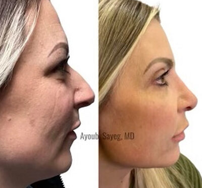 Specials - 63 Laser & Skin Clinic is the Most Affordable Plastic ...