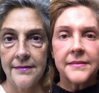 63 Laser & Skin Clinic is the Most Affordable Plastic Surgery Center In ...